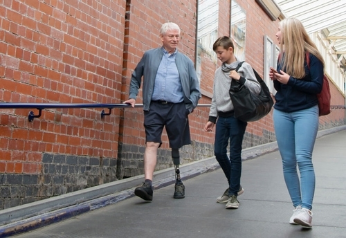 What Are The Different Types of Prosthetics? | PrimeCare