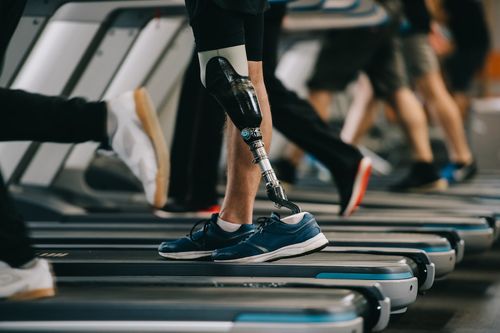 Above Knee Prosthetic Leg | PrimeCare Orthotics & Prosthetics