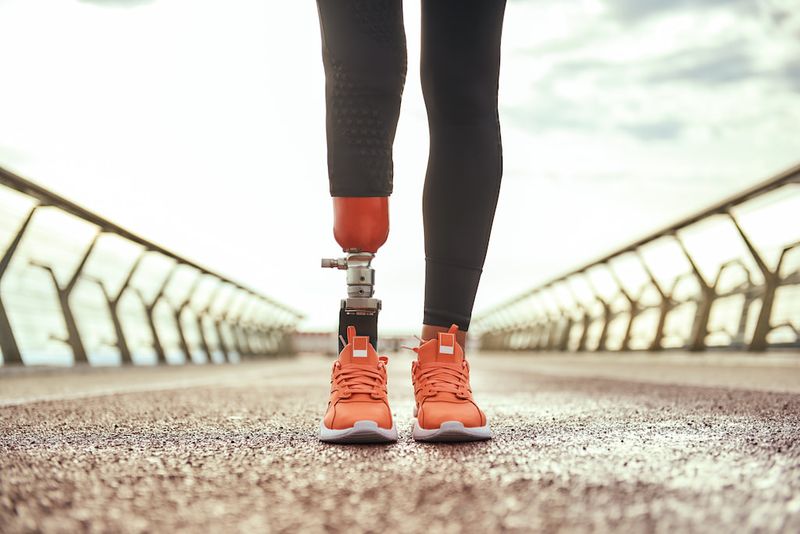 Above Knee Prosthetic Leg | PrimeCare Orthotics & Prosthetics