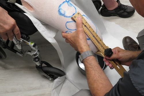 Above Knee Prosthetic Leg | PrimeCare Orthotics & Prosthetics