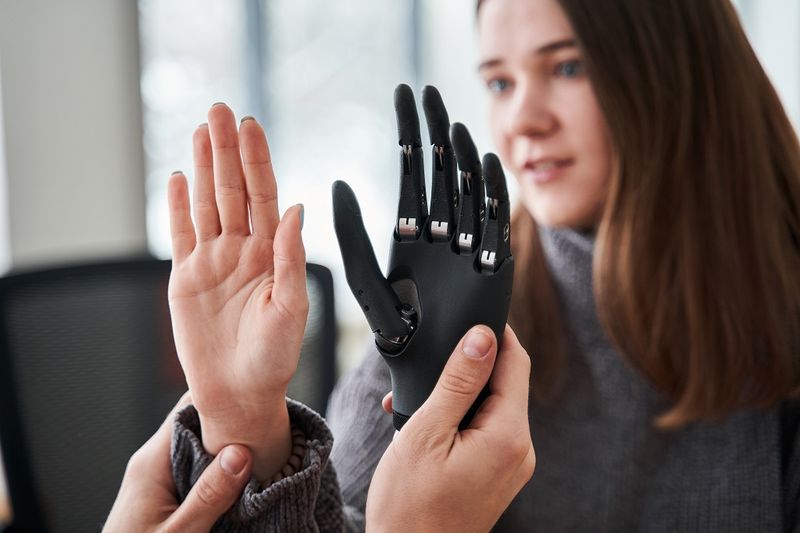 Prosthetic Partial Hand & Fingers in Las Cruces & Albuquerque ...