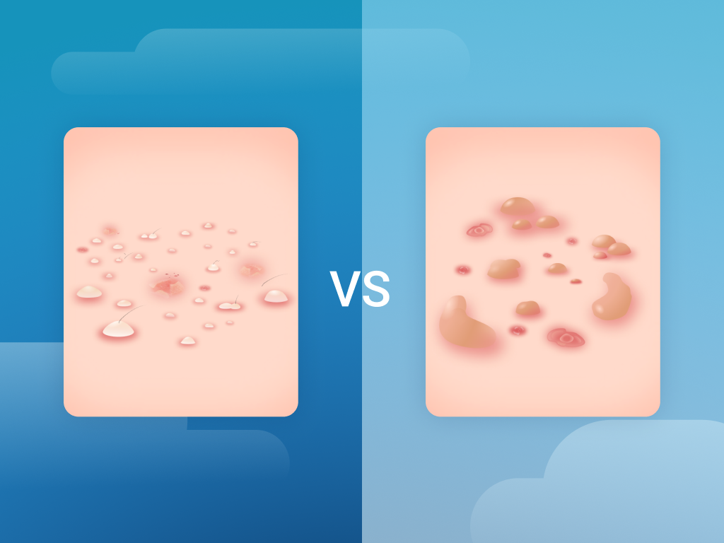 Identifying and Managing Skin Rashes in Children: A Guide for Parents