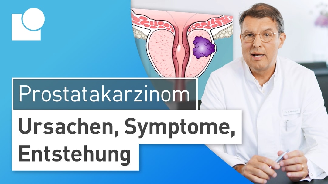 Prostatakrebs - Vorsorge, Diagnose und Therapie