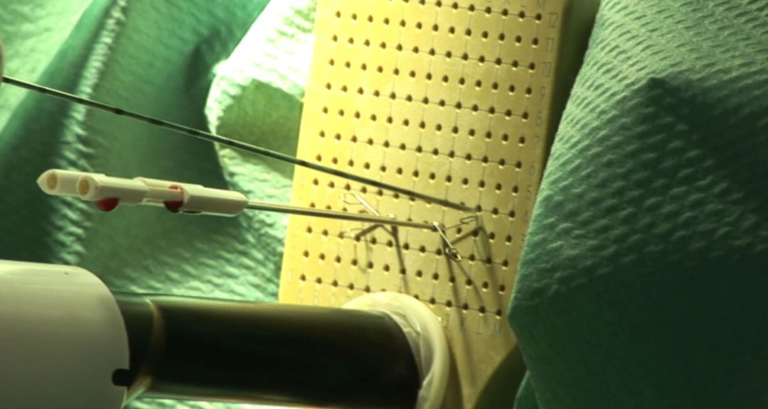 Prostatakrebs - Vorsorge, Diagnose und Therapie