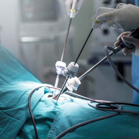 SmartSurgN: Surgery, Simplified.