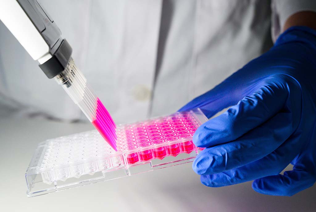 APOPercentage apoptosis assay kit from Biocolor Ltd