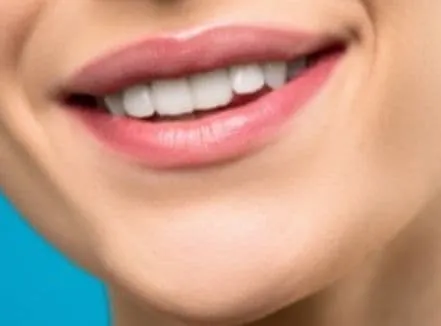 Behandlinger hos vår tannlege i Hamar sentrum · 🦷 HA Tannlege