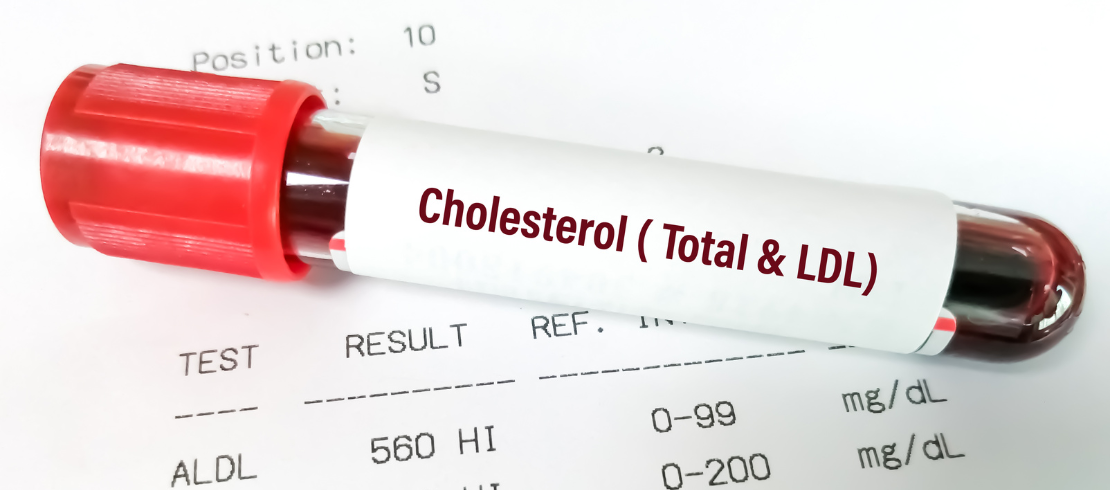 HDL vs LDL Cholesterol: Understanding the Differences | HealthAssure