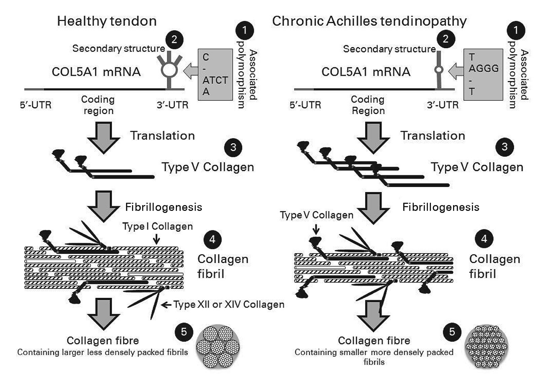 Trait: Musculoskeletal soft tissue injury risk (COL5A1) | FitnessGenes®