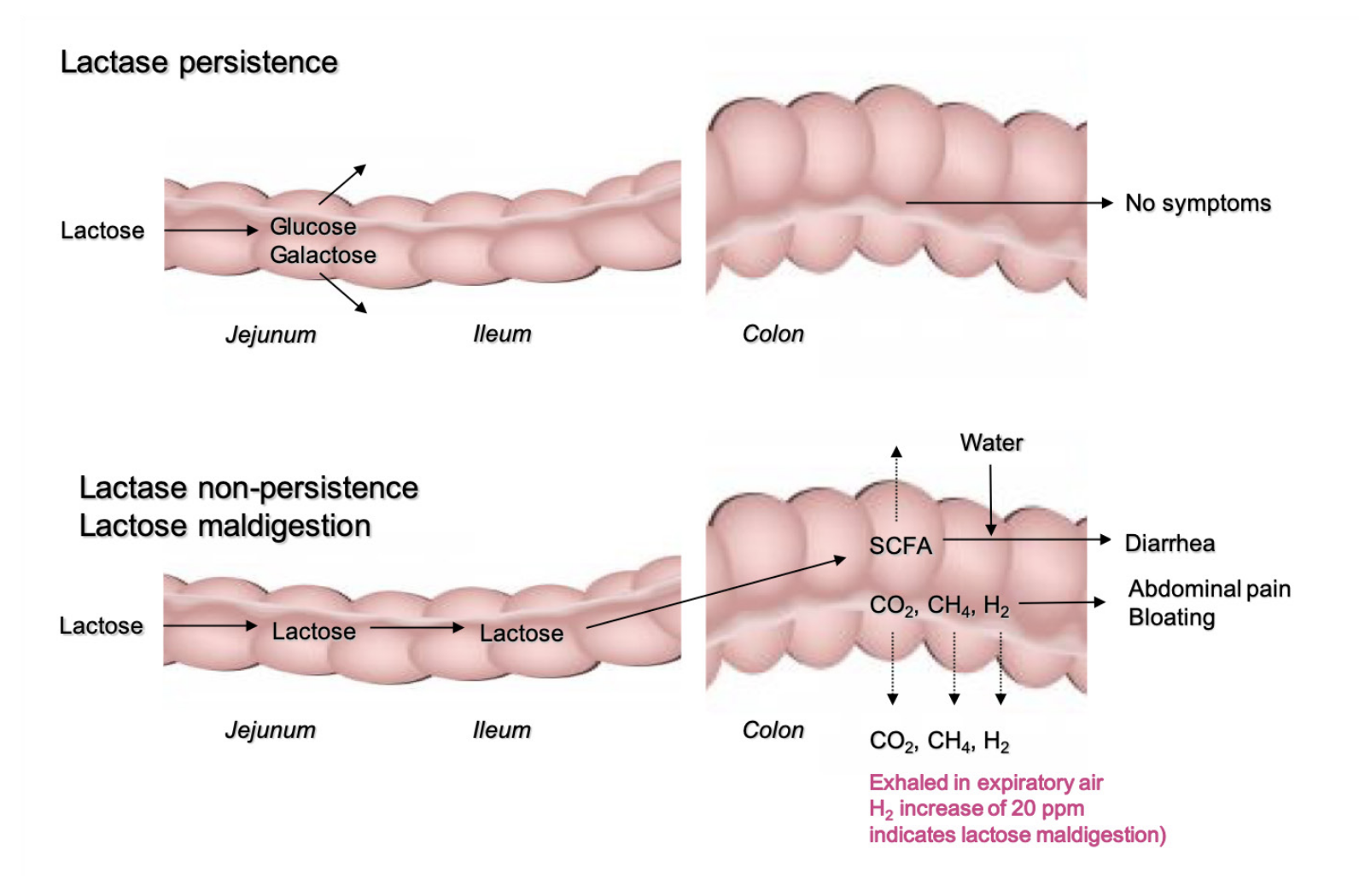 Trait: Lactose tolerance | FitnessGenes®