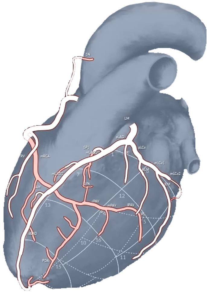 Cohesic, Bringing decision intelligence to cardiac care