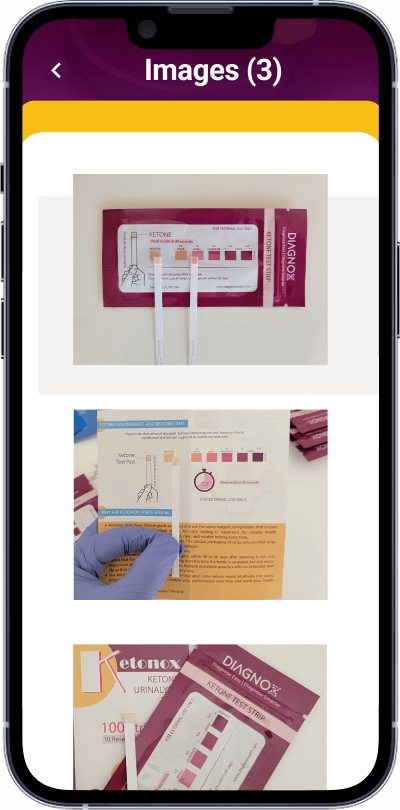 Urinox App: Track & Share Urinalysis Test Results | Diagnox