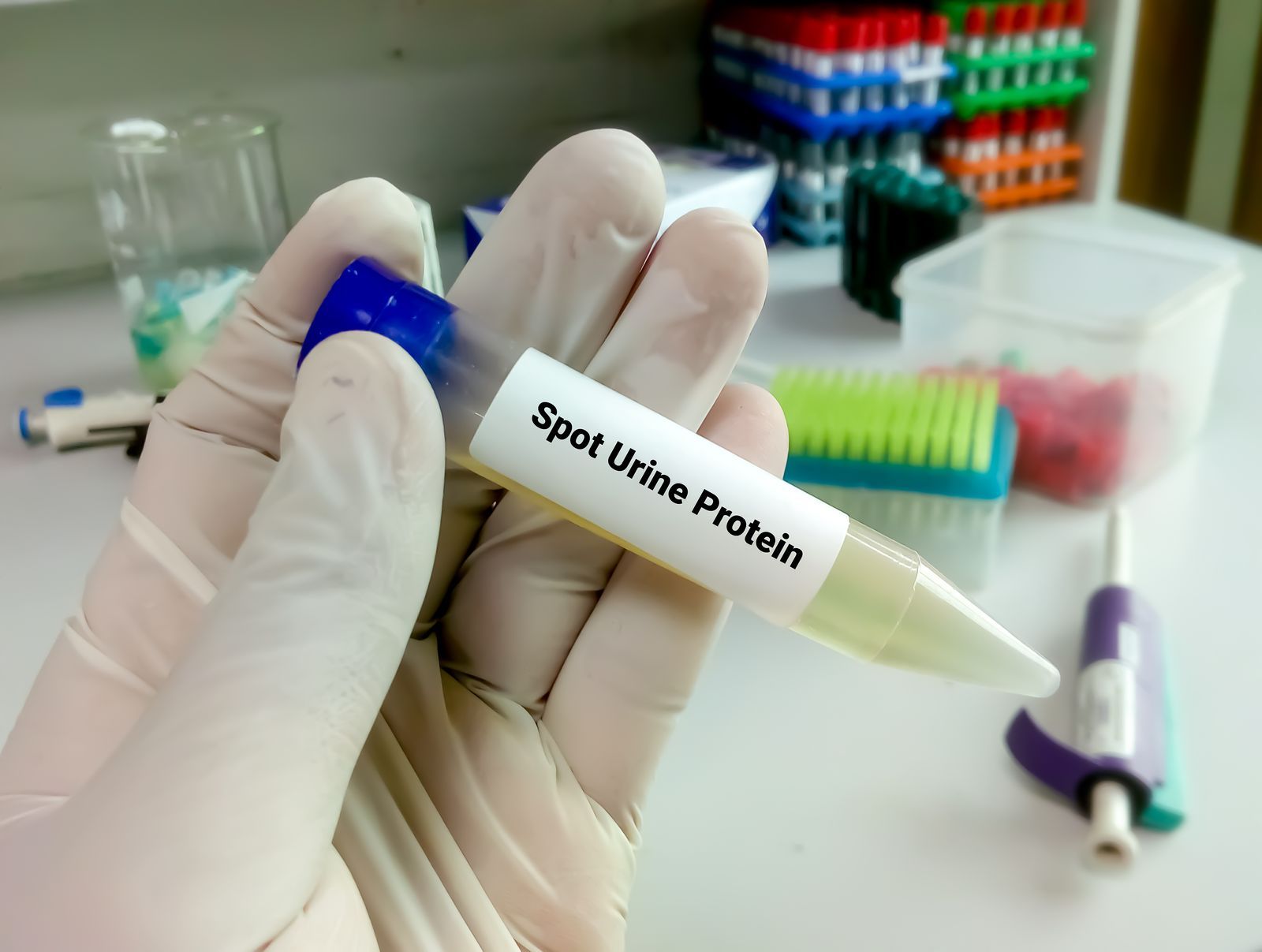 Urinox-10: Multiparameter Urine Test Strips | Diagnox