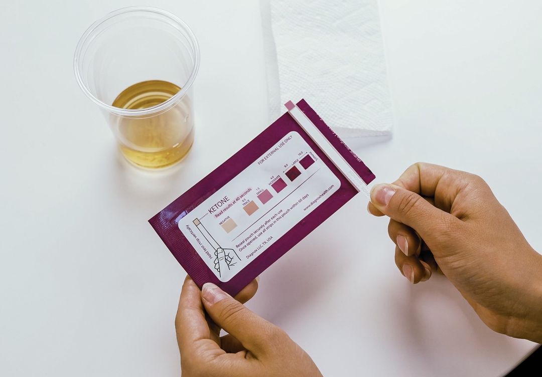 Urinox-10: Multiparameter Urine Test Strips | Diagnox