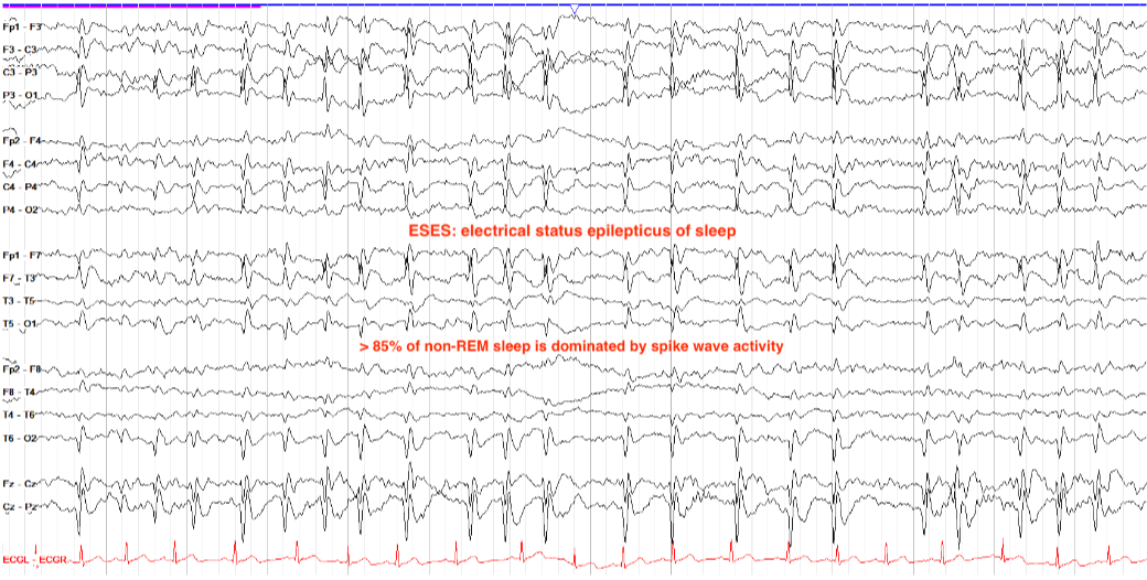 EEG Fun Facts | New Every Friday | Neuro Pathway