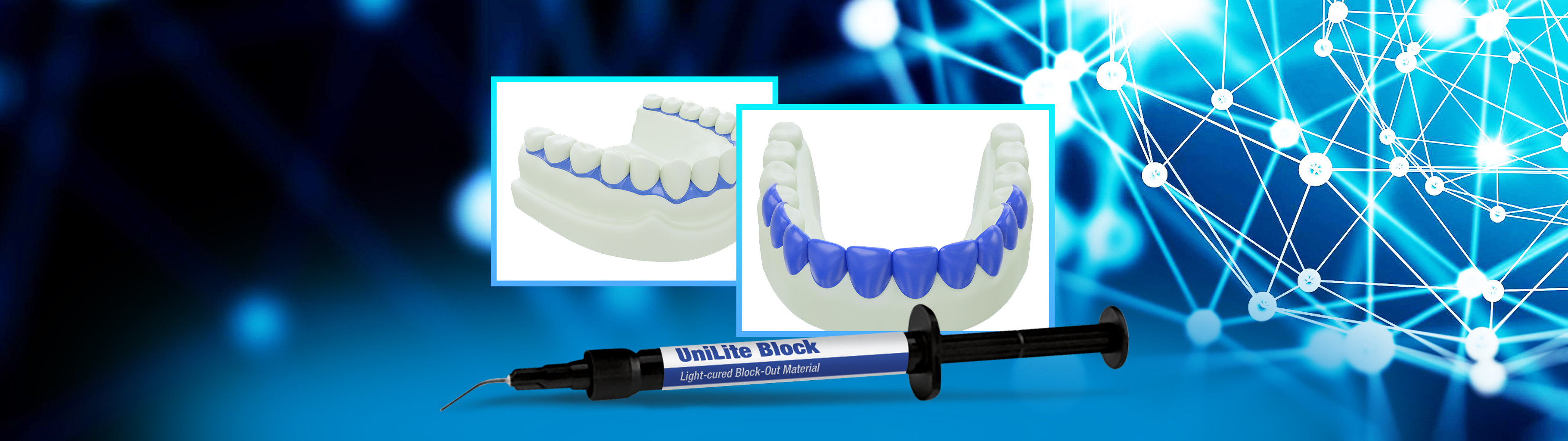 DSI UniLite Block-out Material | DSI Dental Solutions
