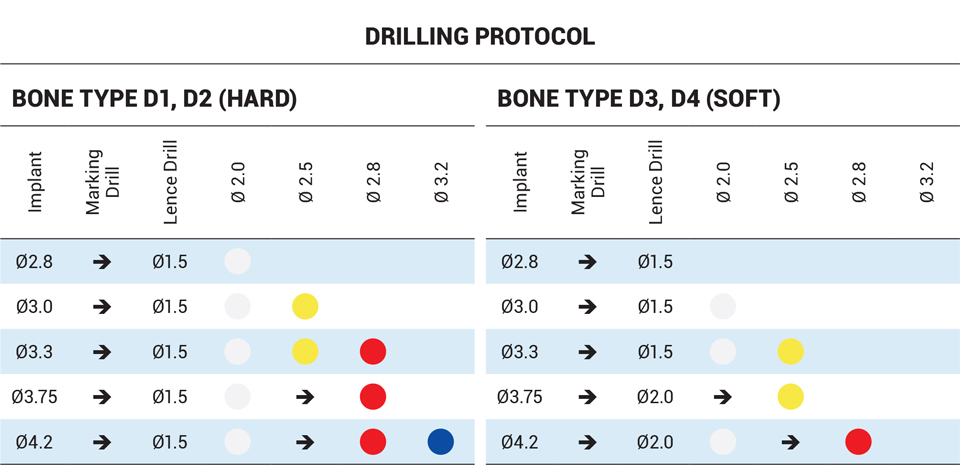 DSI Immediate implant | Discover Dental Products & Solutions