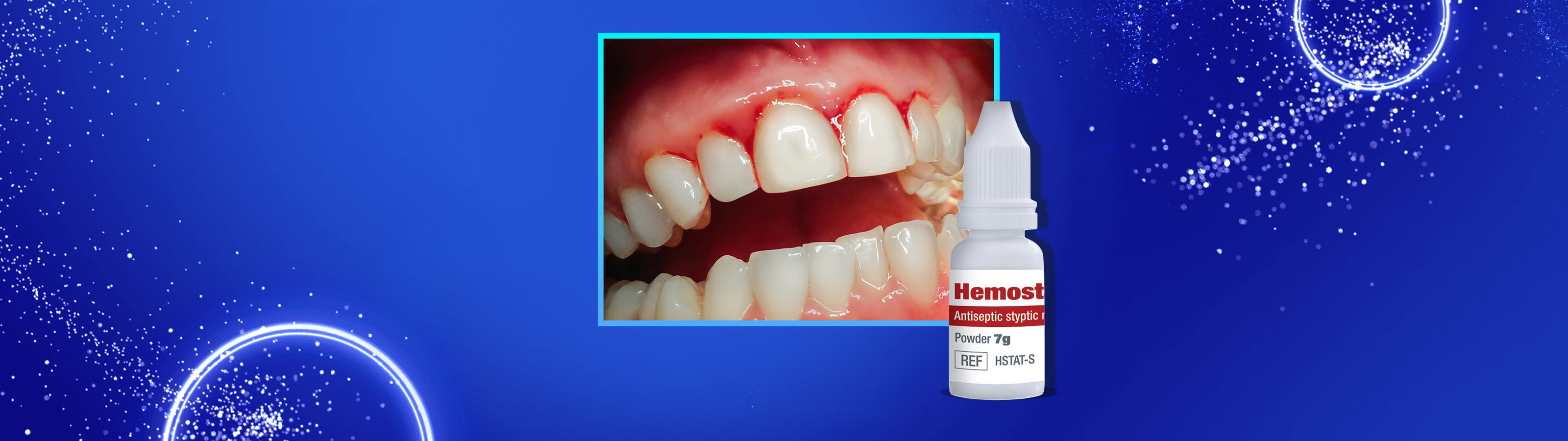 DSI Hemostatic Powder | DSI Dental Solutions