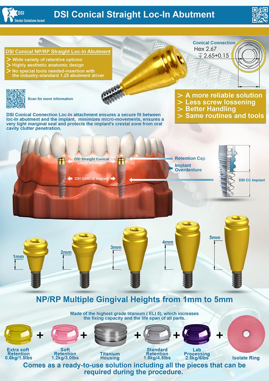 Loc-in Attachment for Overdentures | DSI Dental Solutions