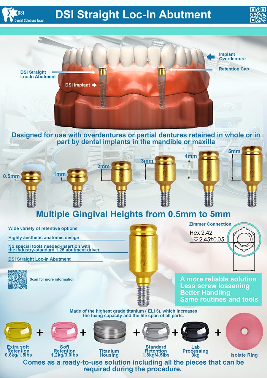 Loc-in Attachment for Overdentures | DSI Dental Solutions