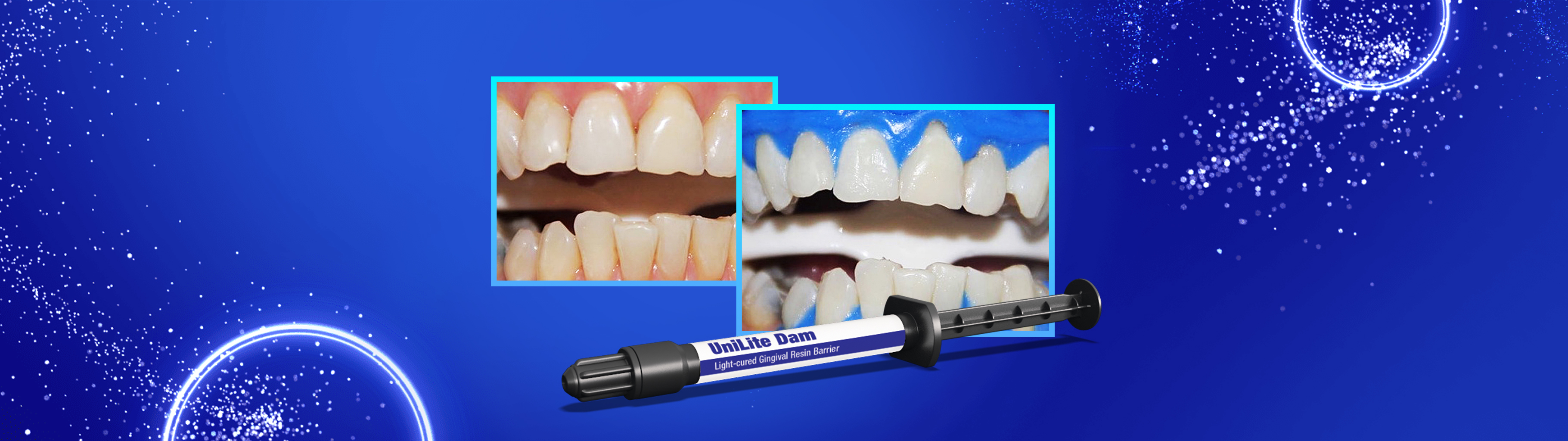 DSI UniLite Dam Resin Barrier | DSI Dental Solutions