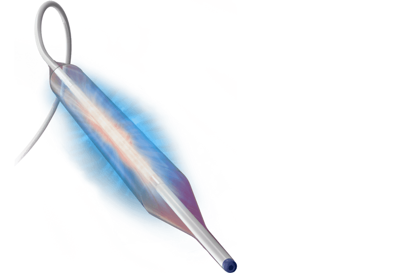 Intravascular Lithotripsy (IVL) Catheters | FastWave Medical