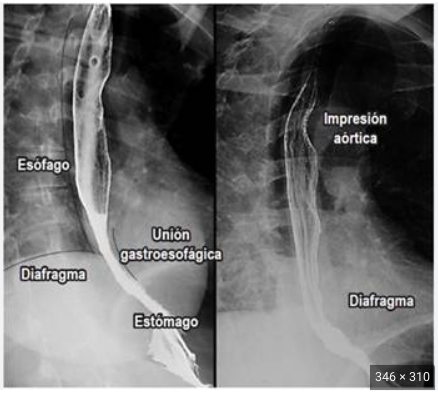 ESOFAGOGRAMA - Doctorate - Webflow HTML website template