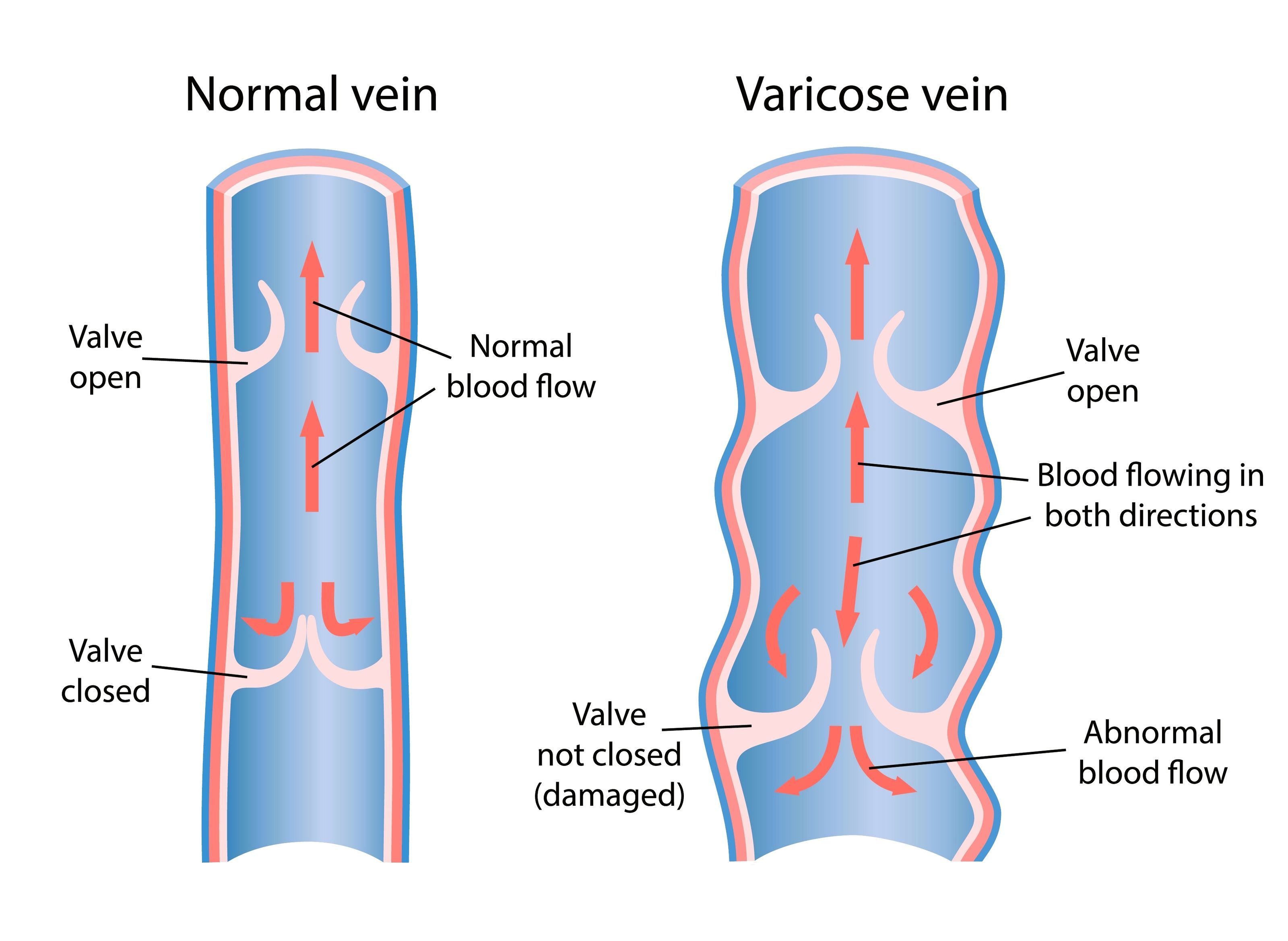 Oasis Vein and Vitality | Scottsdale, AZ | Prescott, AZ