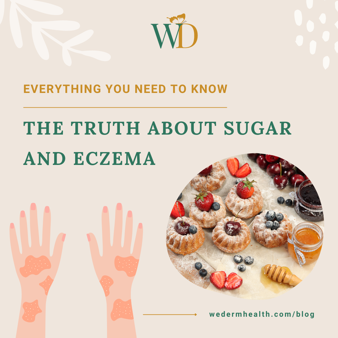 The truth about sugar and eczema: everything you need to know