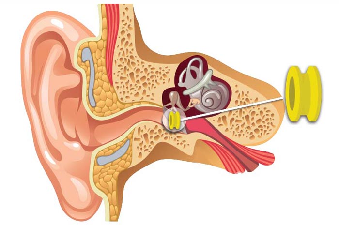 Ear Services - Hong Kong ENT and Sleep Surgery Centre