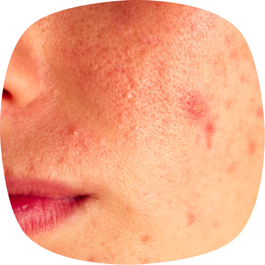 Hoe werkt Skindr | Skindr Online Dermatoloog