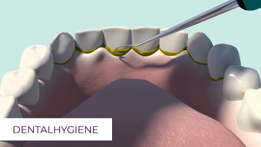 Prophylaxe: Unterschiedliche Massnahmen zur Dentalhygiene