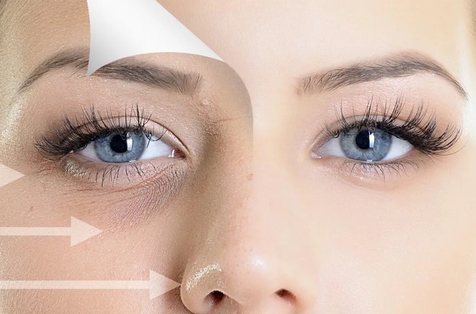 What Is Eye Rejuvenation | Clinique Main D'or