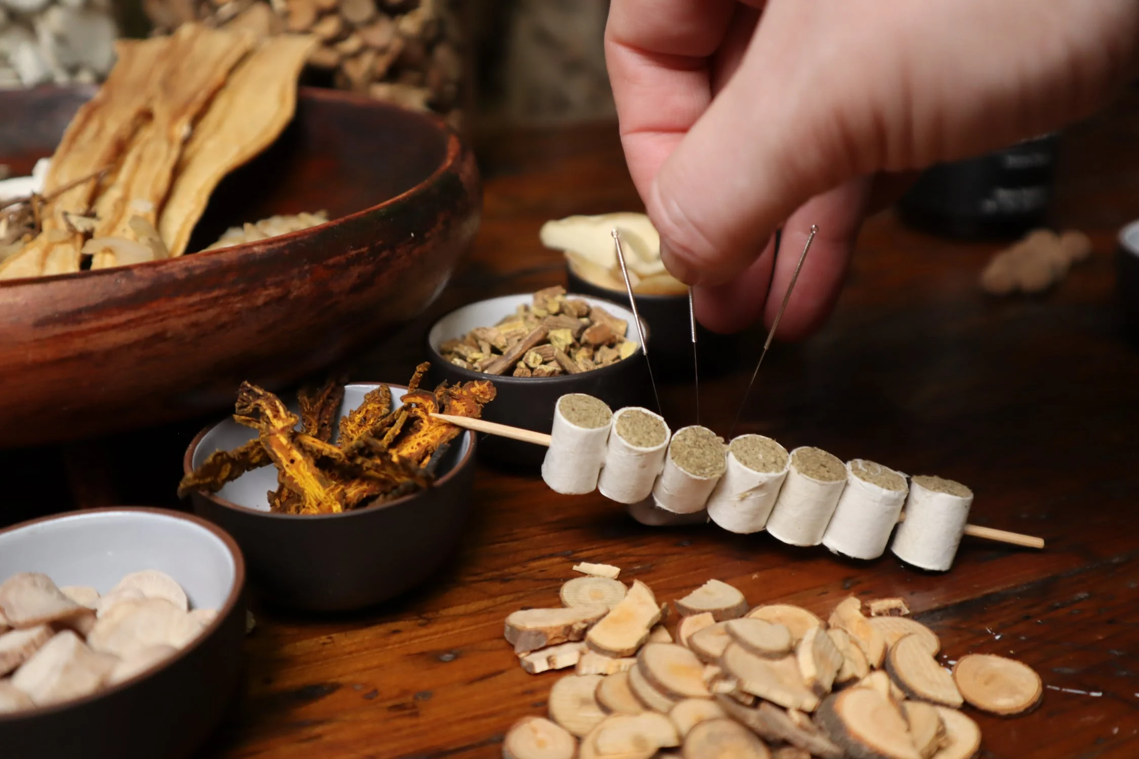 Exploring the Roots of Traditional Chinese Medicine | Joyful TCM