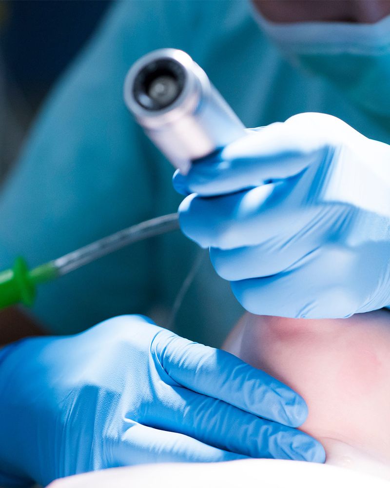 Access Airways | Innovative Intubation Technology