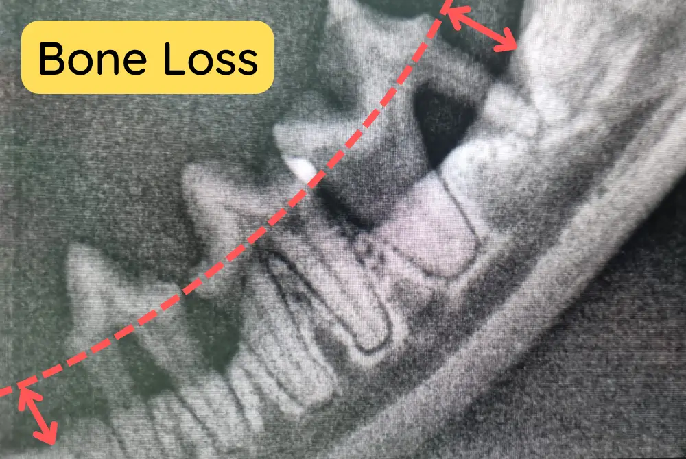 6 Ways to Keep Cats Teeth Clean (With & Without Brushing)