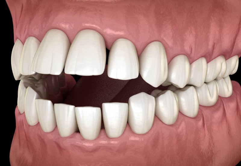 How does Invisalign work and what issues can it fix?