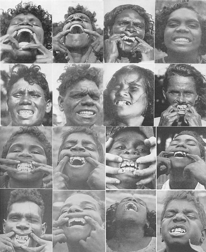 Weston A. Price (Part 1/3): His Findings