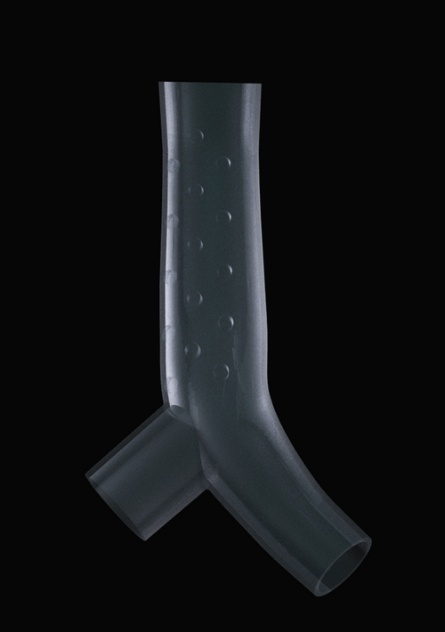 Patient-Specific Stents