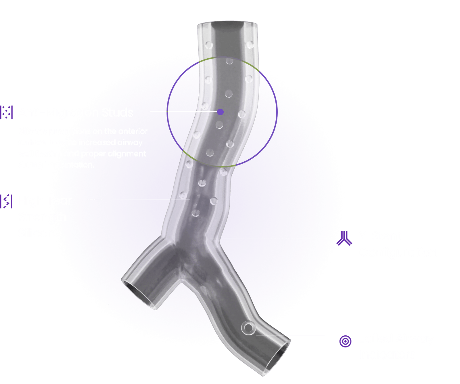 Patient-Specific Stents