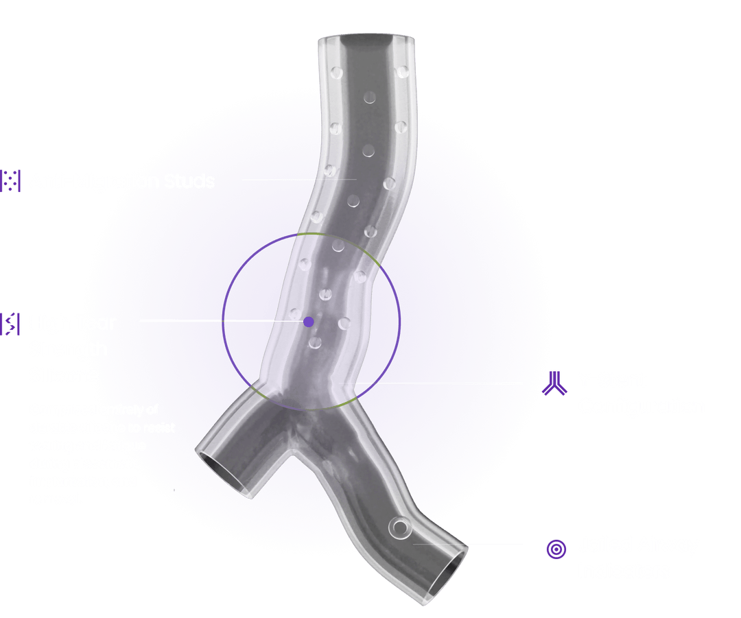 Patient-Specific Stents
