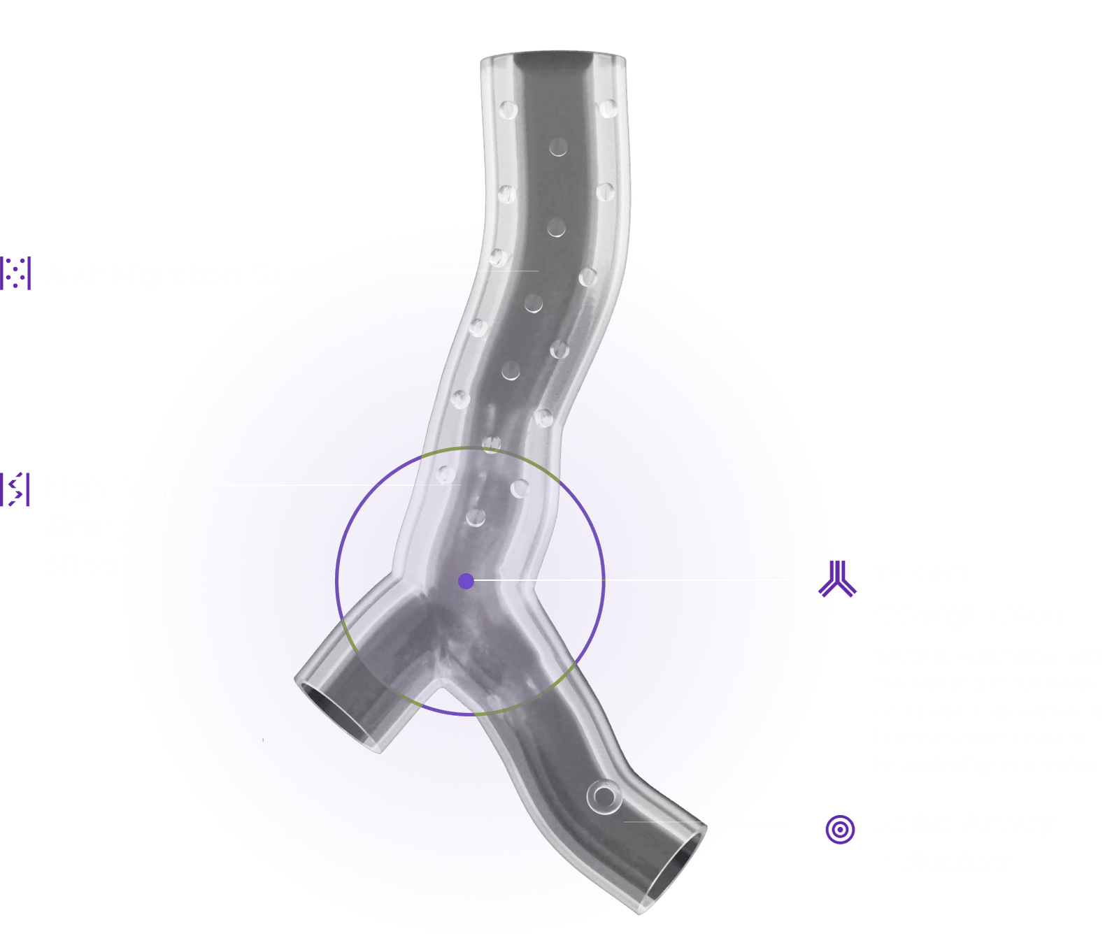Patient-Specific Stents