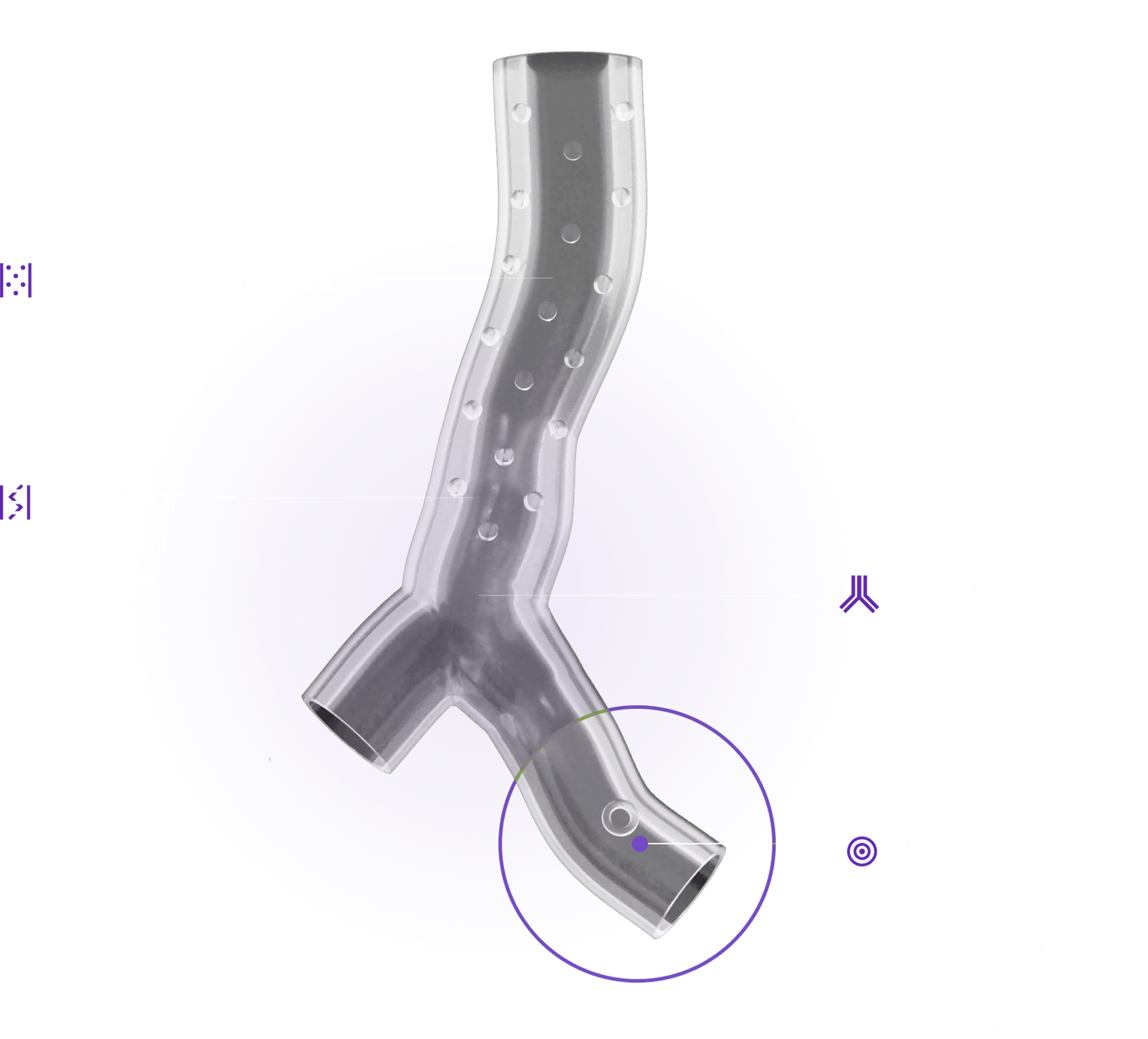 Patient-Specific Stents
