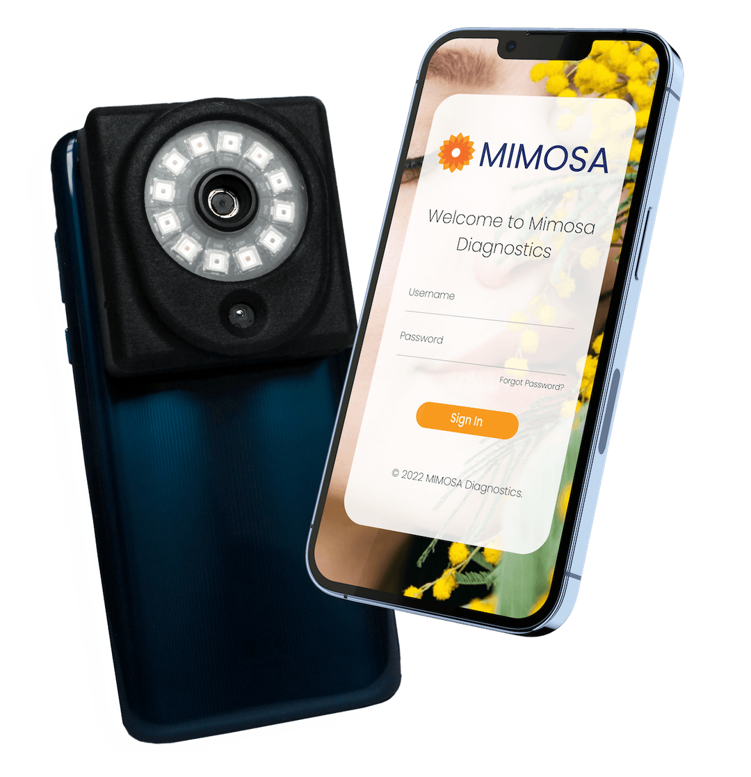 MIMOSA Pro | Handheld Imaging Device