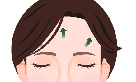 Eyebrow Bone Reduction • Endoscopic Facial Feminization