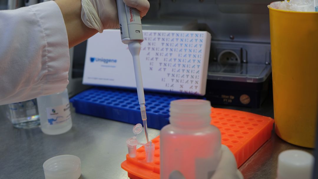 Uniqgene | Sports DNA Test