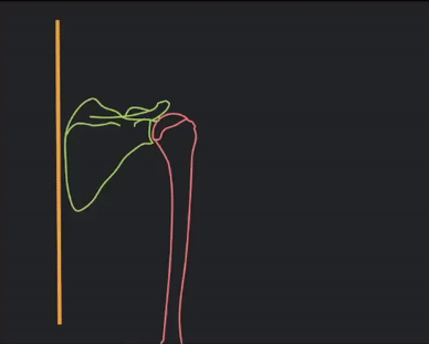 Reinventing the Shoulder | Core Advantage