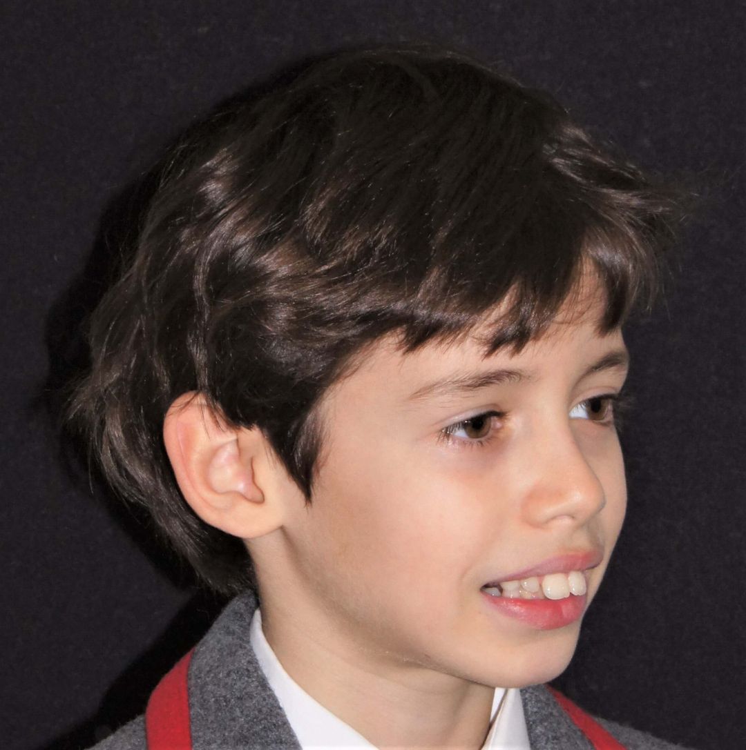 Results and Testimonials | Bass Orthodontics London