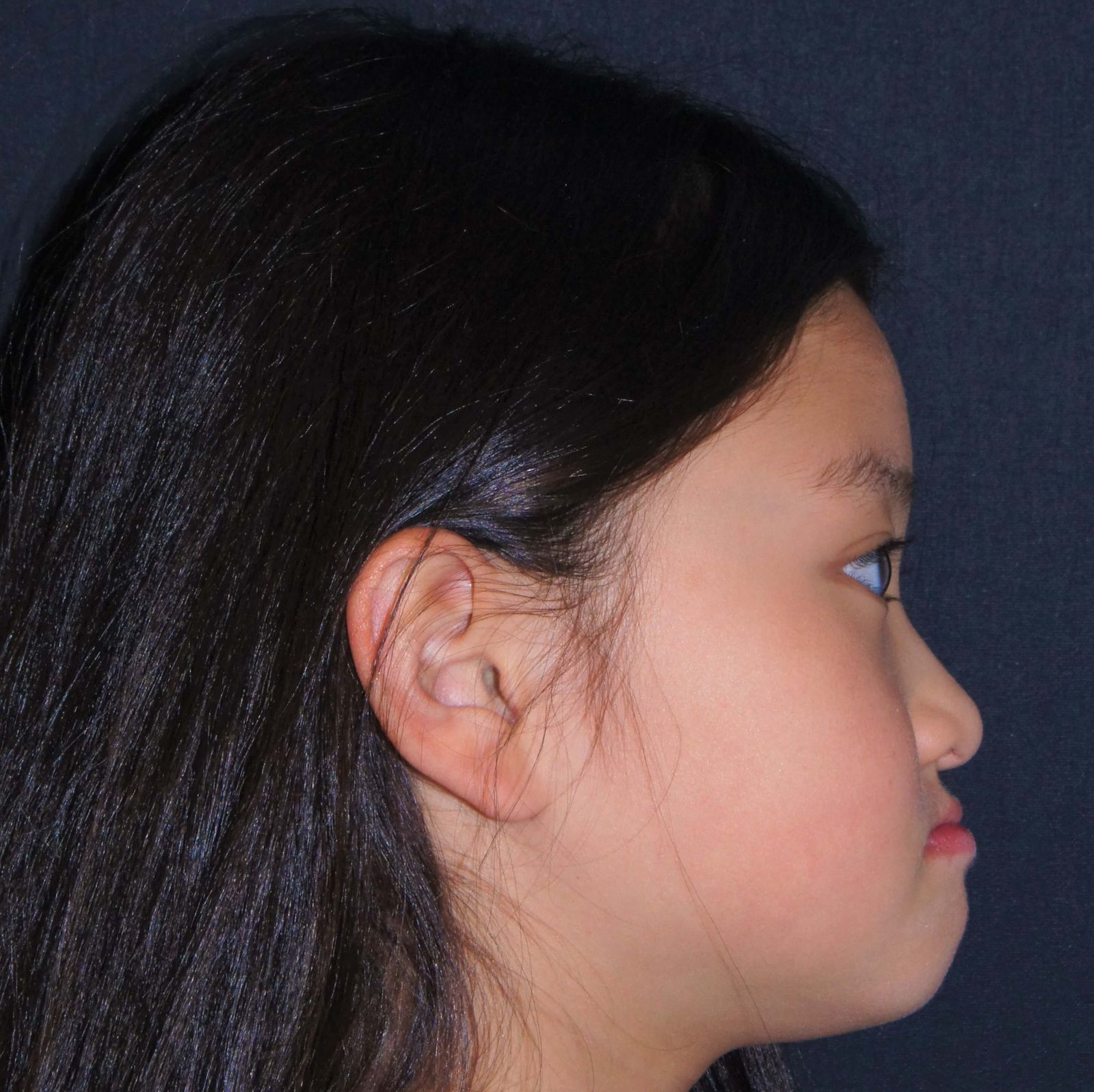 Results and Testimonials | Bass Orthodontics London