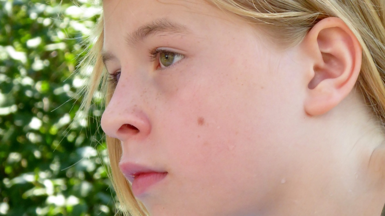 Sun Spot or Skin Cancer: Understand the Difference